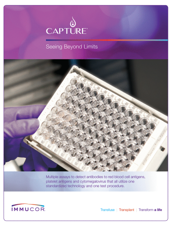 Automated Capture-R Ready-Screen | RBC Antibody Screen Assays | Immucor