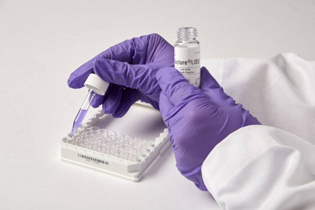 Capture Workstation | Semi-Automated Blood Bank System | Immucor