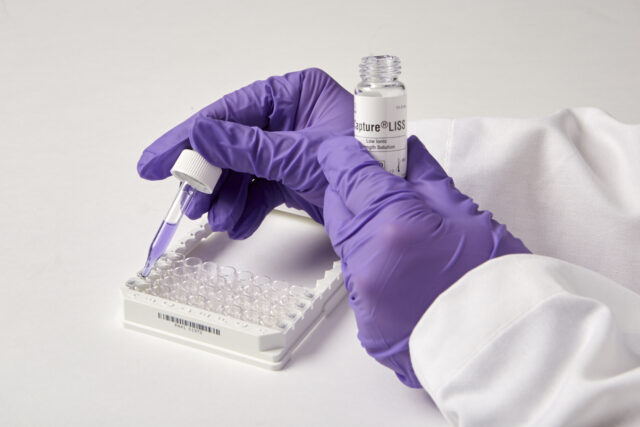 Capture Workstation | Semi-Automated Blood Bank System | Immucor