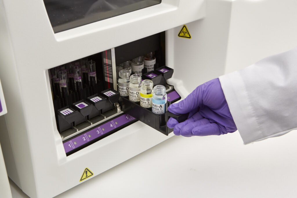 Echo Lumena | Fully-Automated Blood Bank System | Immucor