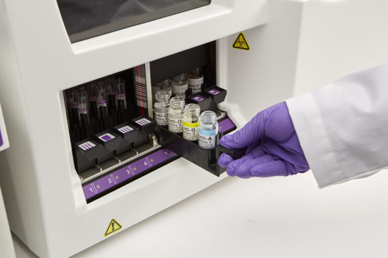 Echo Lumena | Fully-Automated Blood Bank System | Immucor