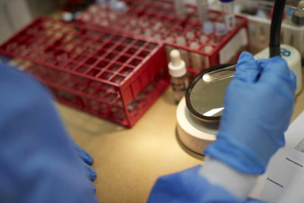 Anti-Human Globulin Reagents | Immucor