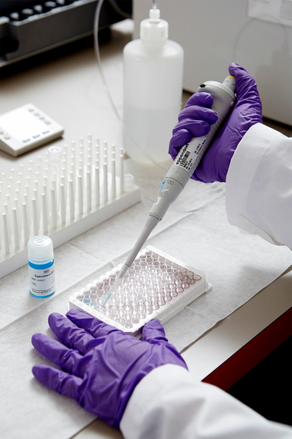 Transfusion | Serology-Based Reagents & Instruments For Pre-Transfusion ...