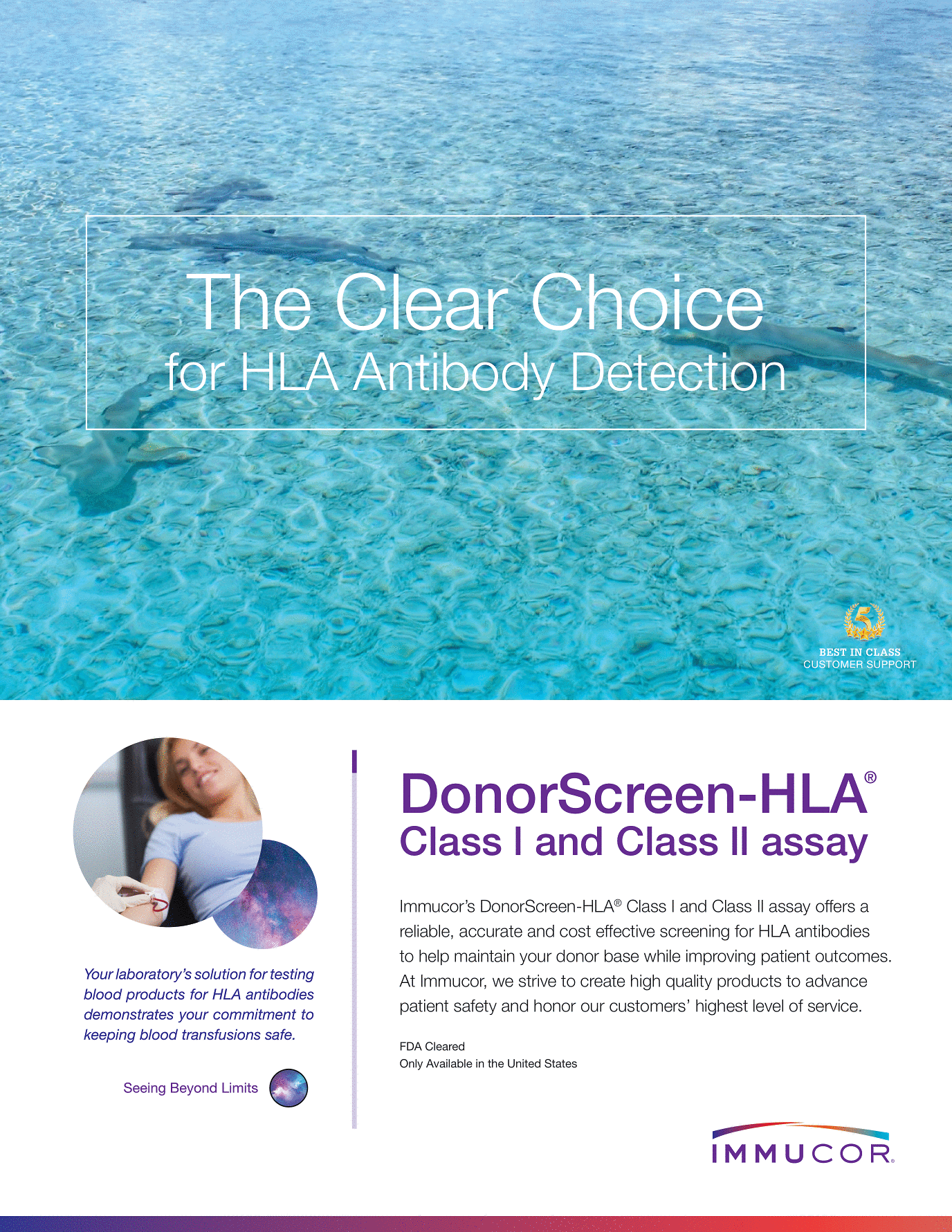 HLA Donor Screening | GEMINI & DonorScreen-HLA® Class I and Class II ...