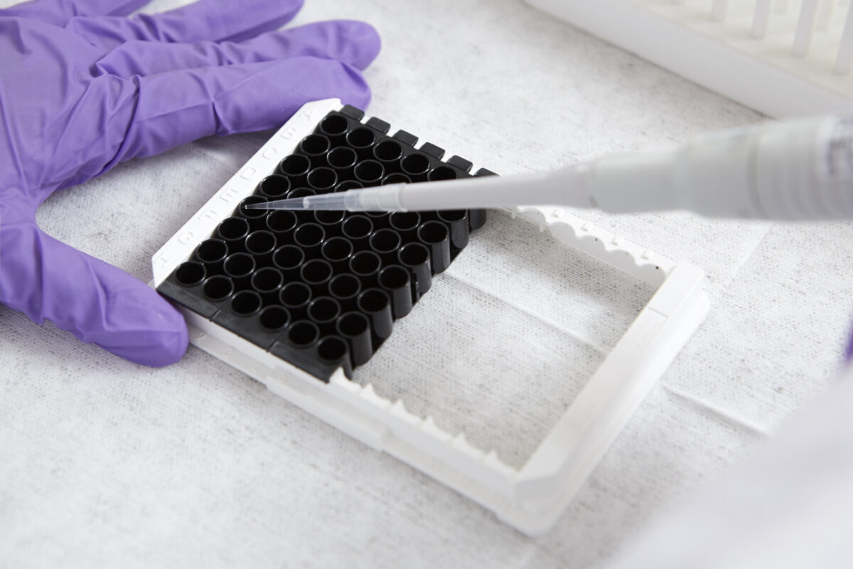 PF4 Products | Coagulation Assays | Immucor