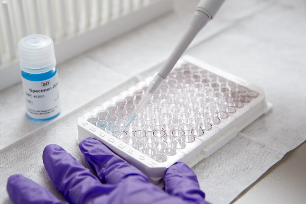 PF4 Products | Coagulation Assays | Immucor