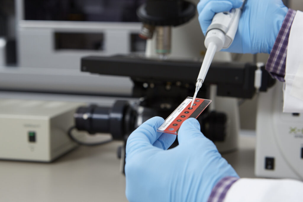 ImmuLINK Data Management | Easy & Efficient Blood Bank Test Data ...