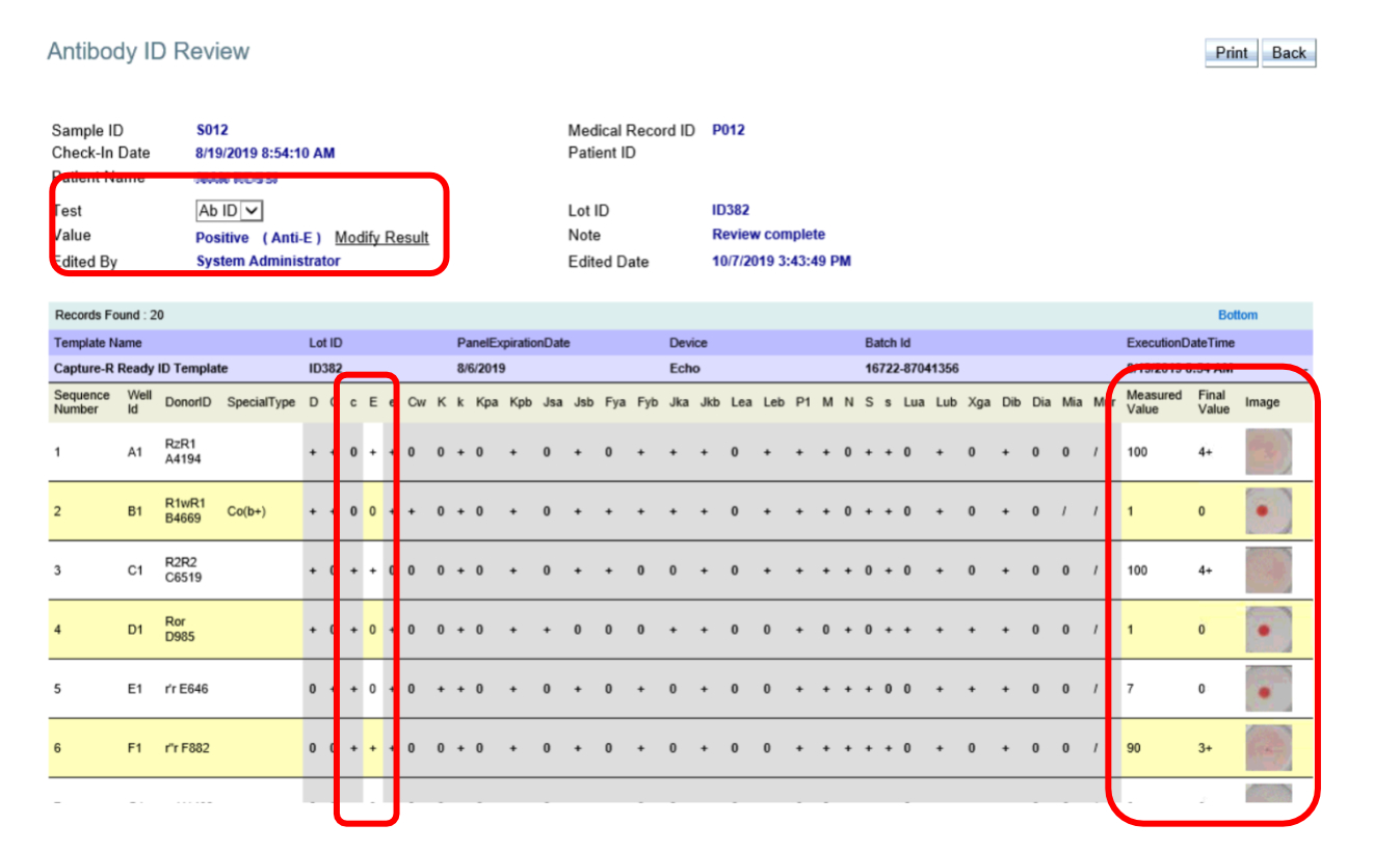 ImmuLINK v2.0 | Werfen