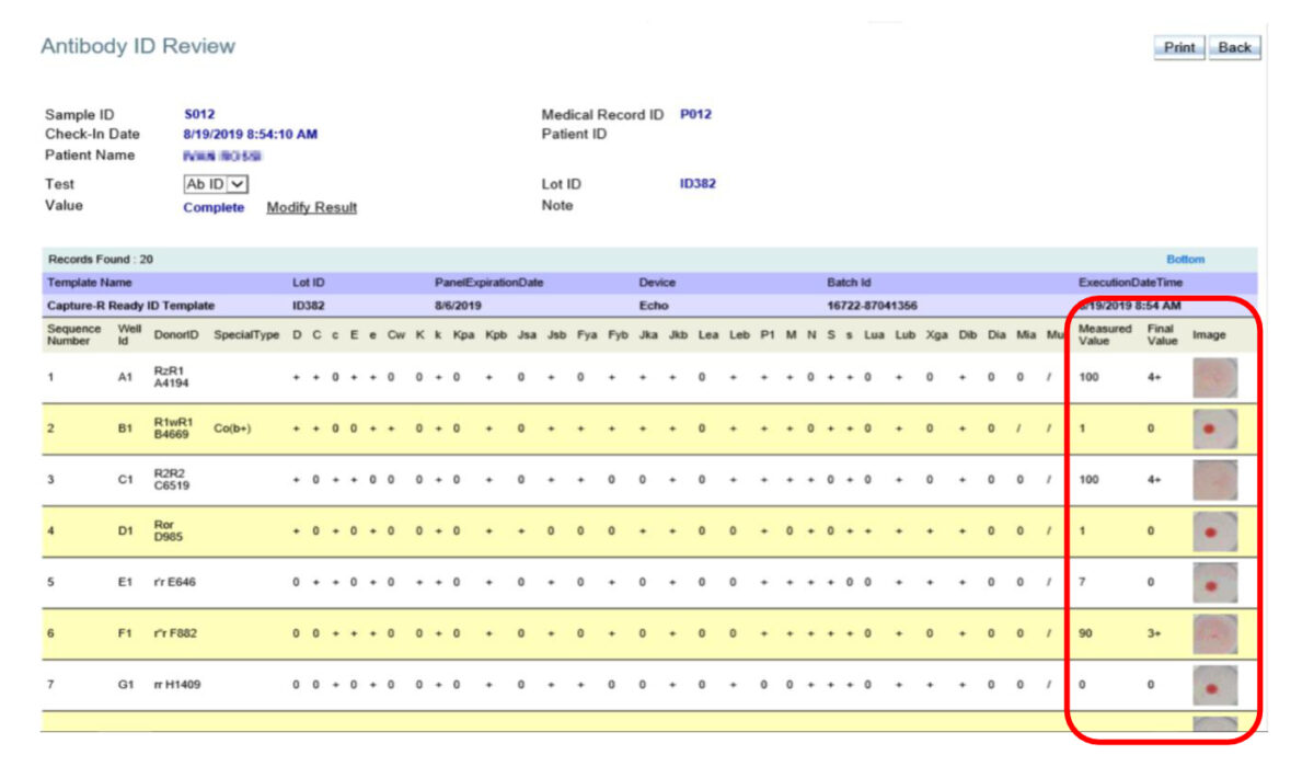 ImmuLINK v2.0 | Immucor